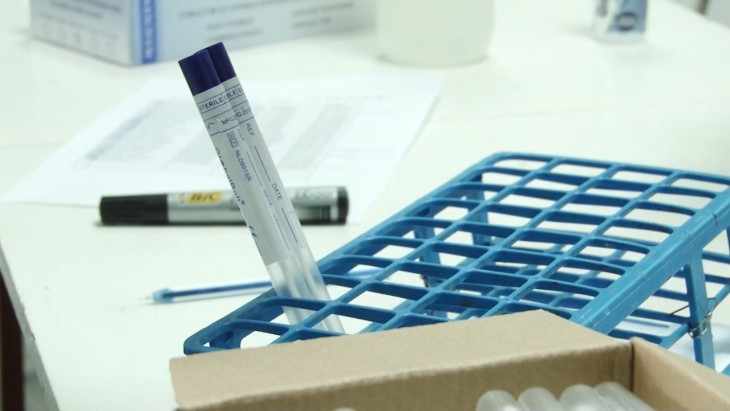 COVID-19: 81 new cases, 124 recoveries